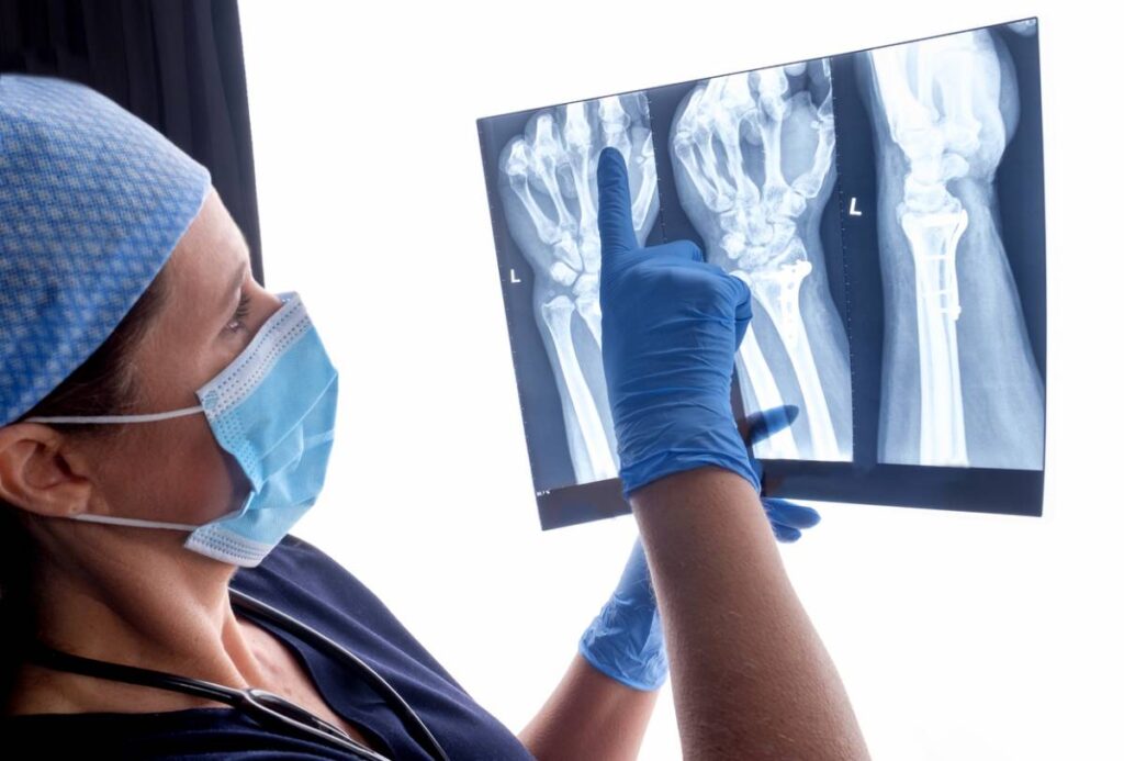 Need for Surgery in Bone Fractures - Alabama Anesthesia